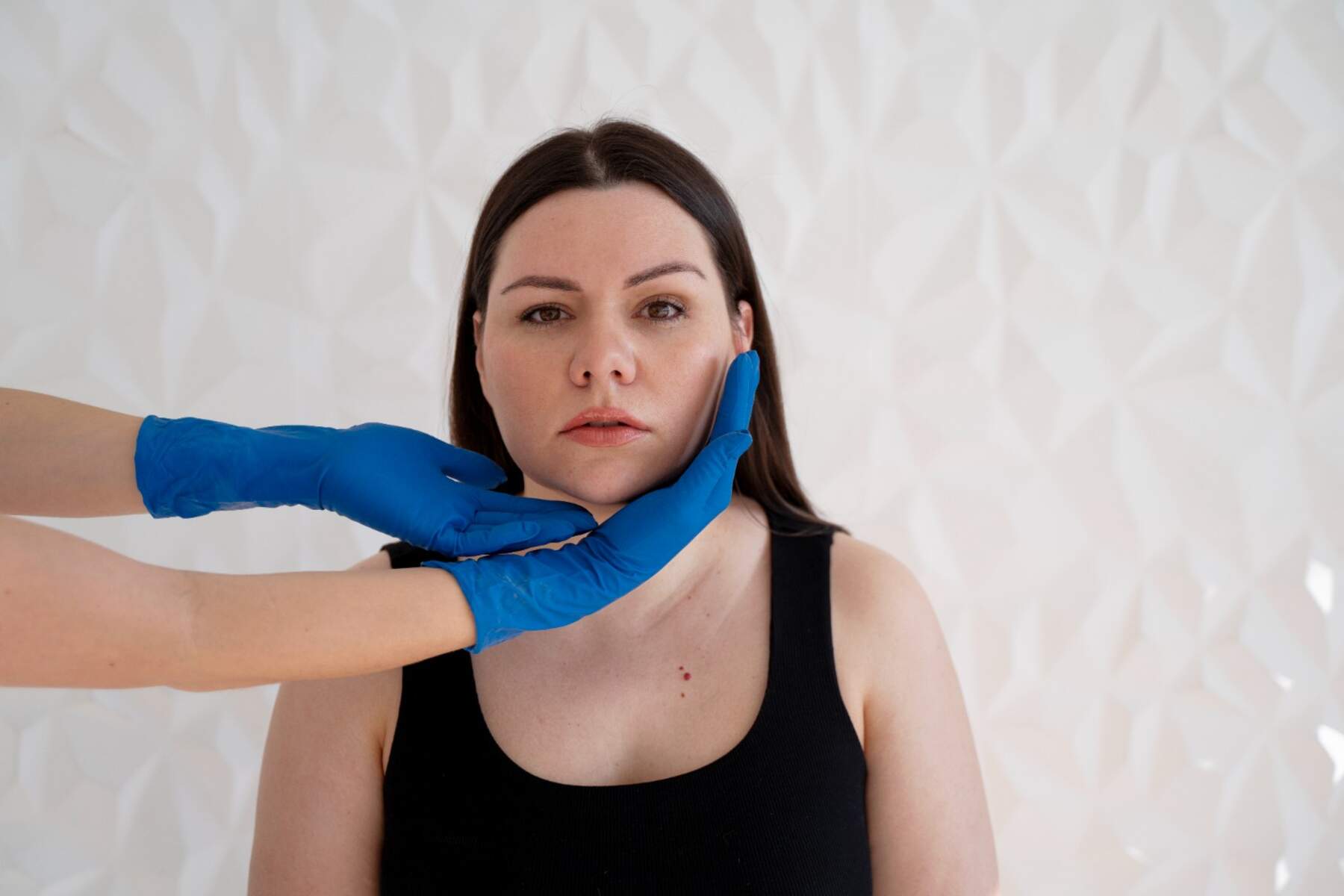 Double Chin Liposuction in Albania for a Slim Face